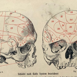 HUMAN SKULL Print C. 1900 Original Antique Print Antique Skeleton Print ...