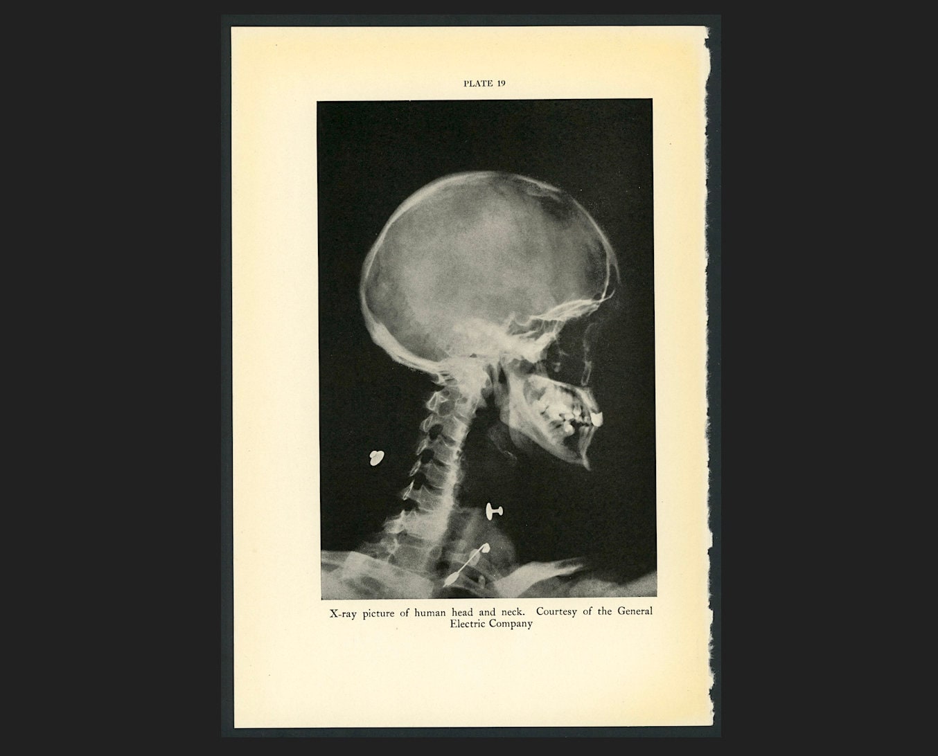 X Ray Human Skull