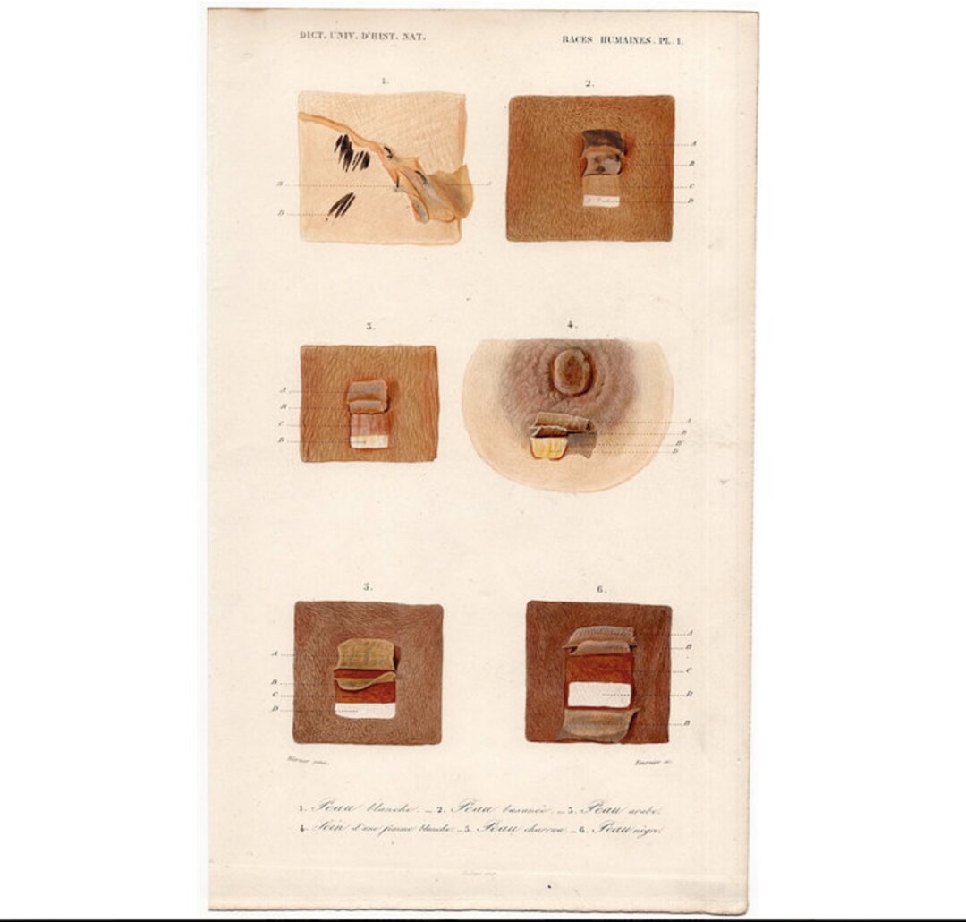 C. 1849 SKIN TISSUE Print Original Antique Print Human Anatomy Print ...