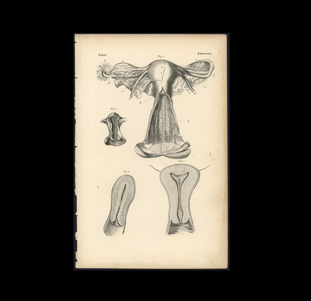 C. 1860 CERVIX & UTERUS PREGNANCY Print • Original Antique Print ...