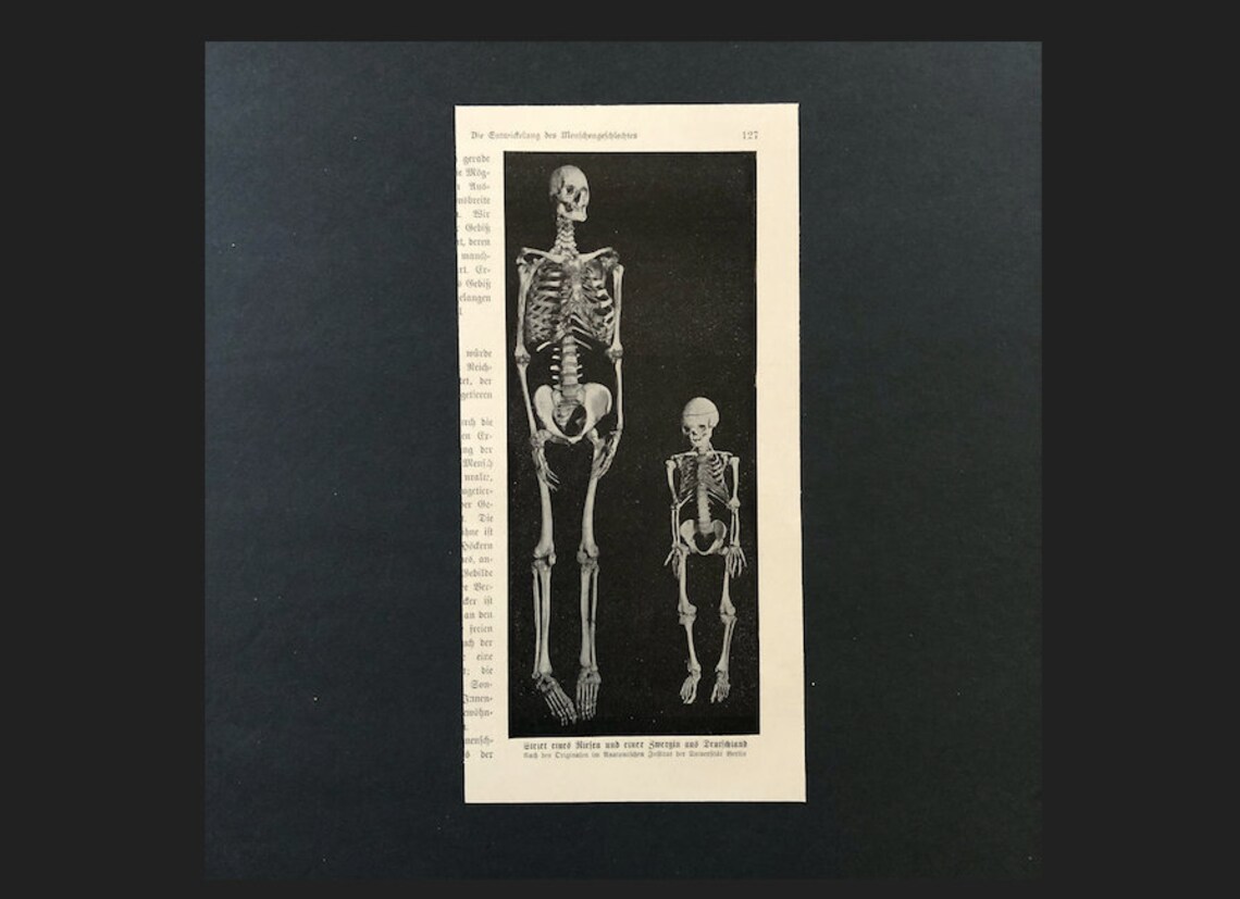 HUMAN SKELETONS Print C. 1900 • Original Antique Print • Antique ...
