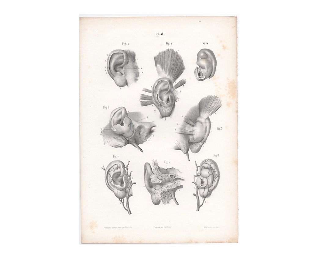 C. 1866 EAR ANATOMY Lithograph • Original Antique Print • Human Anatomy ...