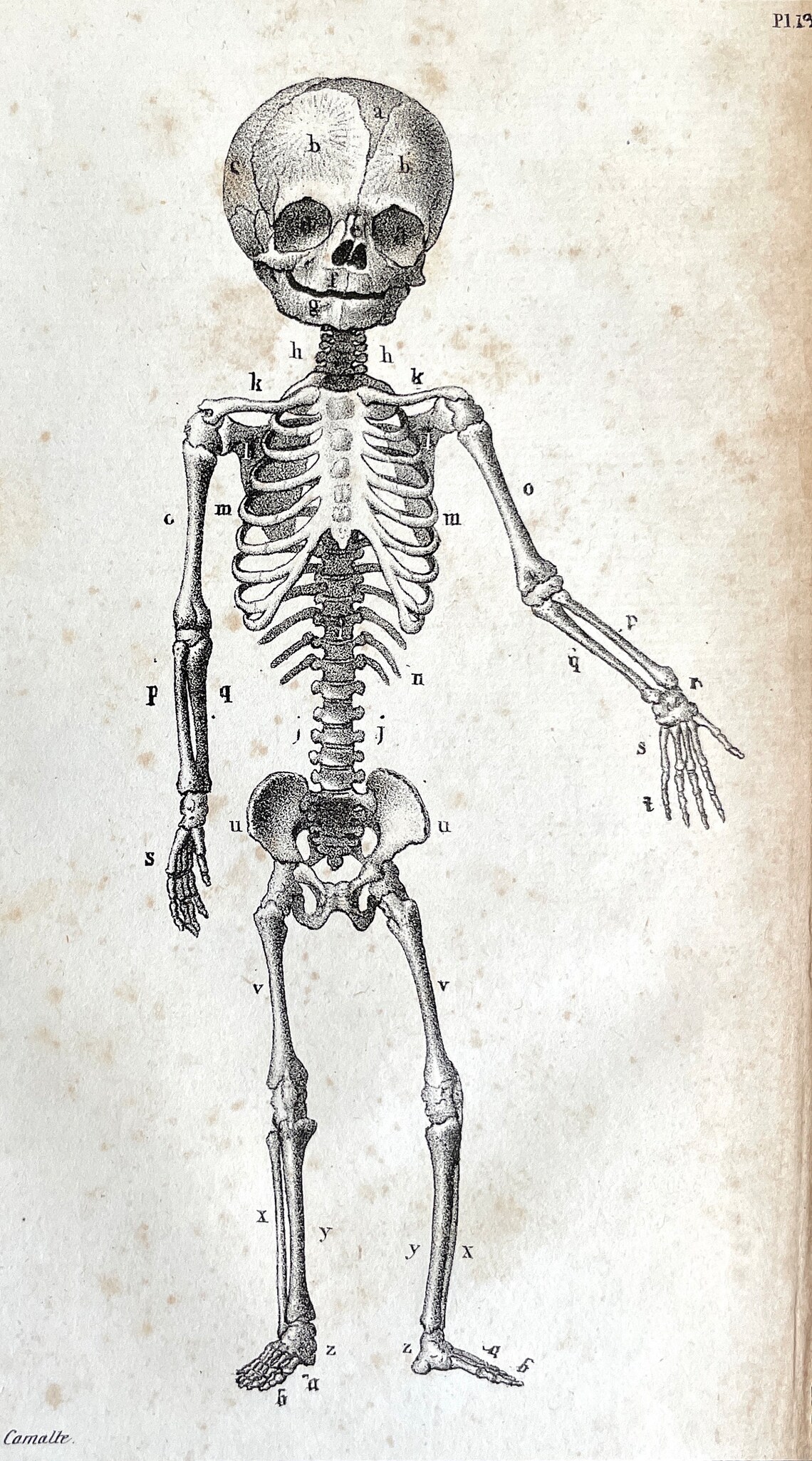 FETUS SKELETON Lithograph C. 1835 • Original Antique Print • Fetal ...