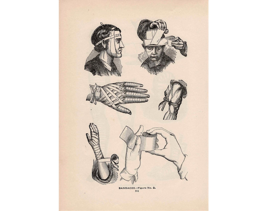C. 1903 BANDAGES Print • Original Antique Print • Medical Illustration ...