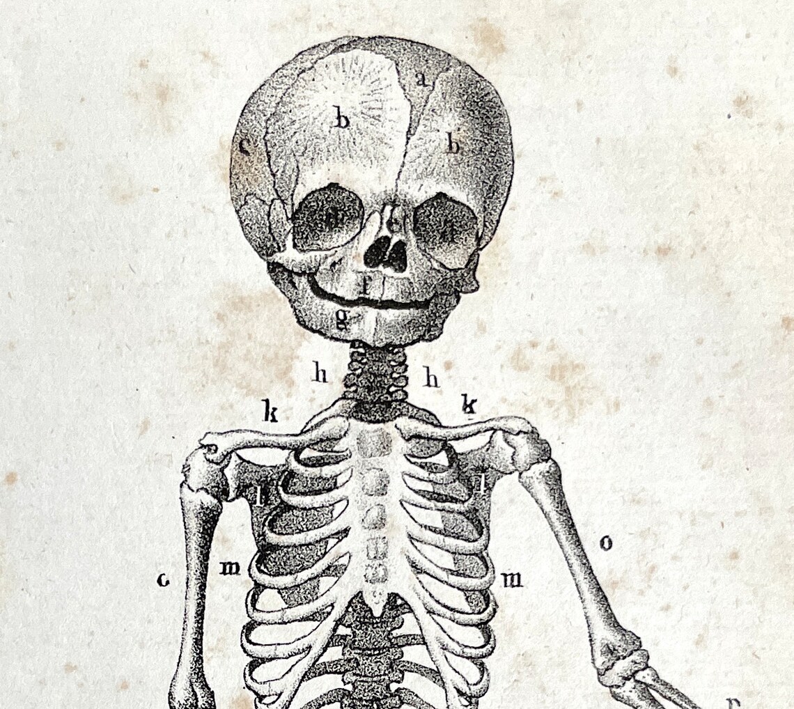 FETUS SKELETON Lithograph C. 1835 • Original Antique Print • Fetal ...