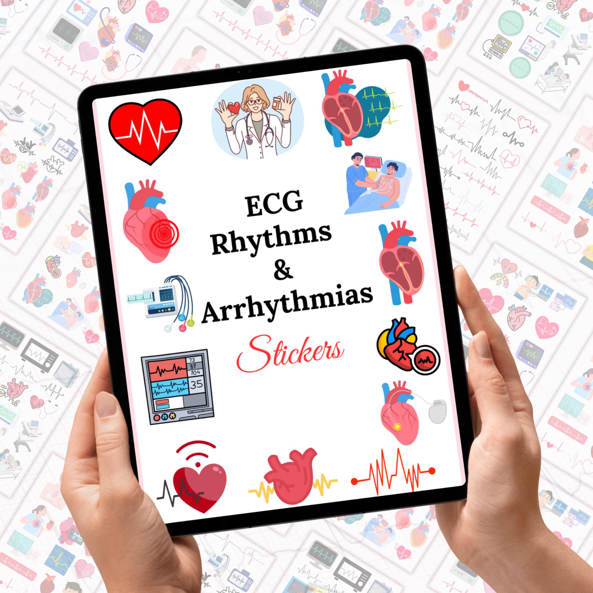 ECG Rhythm & Arrhythmias Cheat Sheet: Nursing Study Guide (digital ...