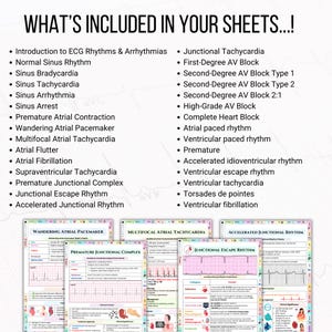 ECG Rhythms & Arrhythmias Cheat Sheet, Cardiac Nursing Study Guide, EKG ...