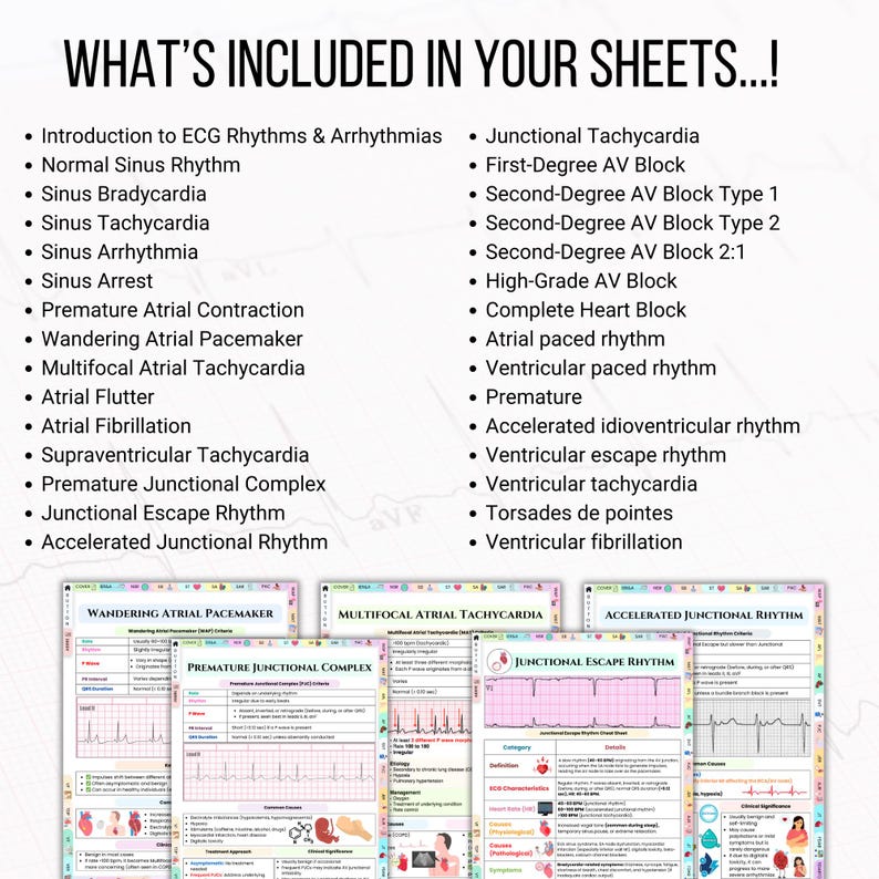 ECG Rhythm & Arrhythmias Cheat Sheet: Nursing Study Guide (digital ...