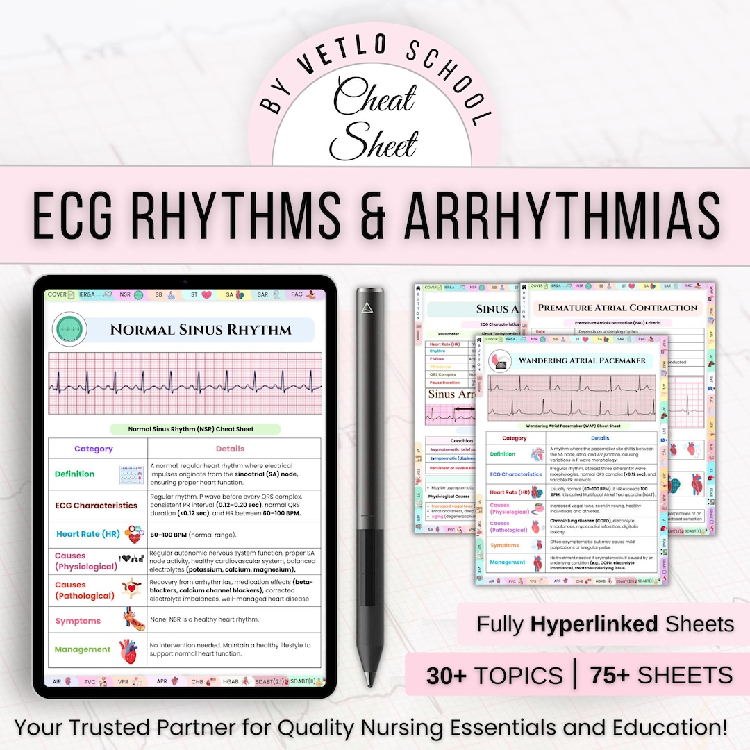 75+ ECG Rhythm & Arrhythmias Cheat Sheet, ECG Study Guide, Nursing ...