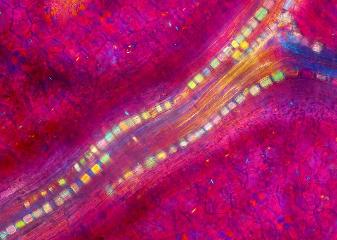Calcium Oxalate Prisms in Leaf, Natural Arrangement of Colorful ...