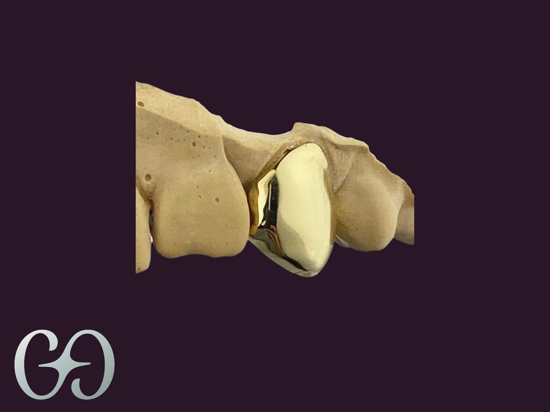 Custom Gold/silver Single Tooth Cap — Handmade Grillz | Minimal Hip Hop ...