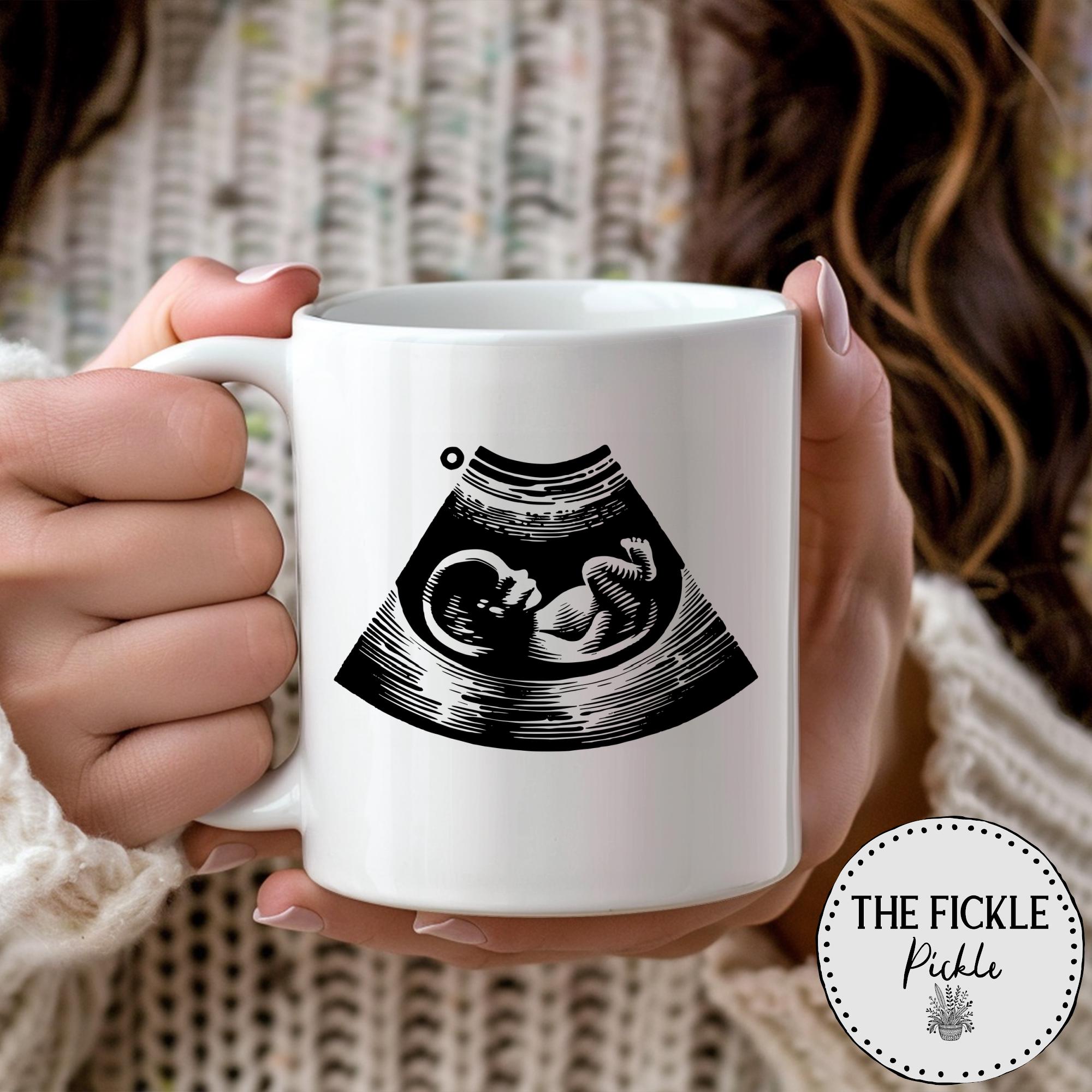 Ultrasound Sonogram Vector Clipart Png, Outline & Black Silhouette ...