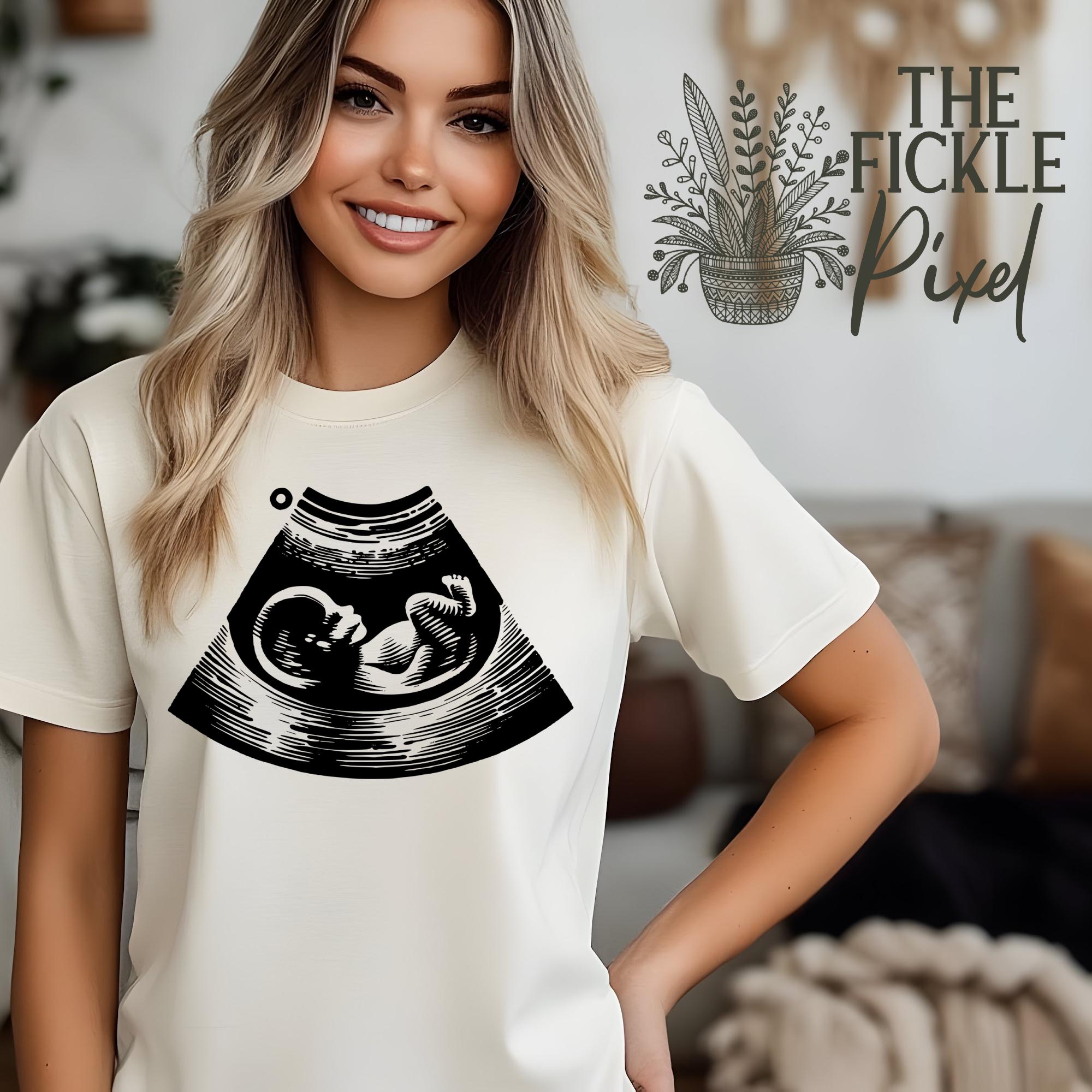 Ultrasound Sonogram Vector Clipart Png, Outline & Black Silhouette ...