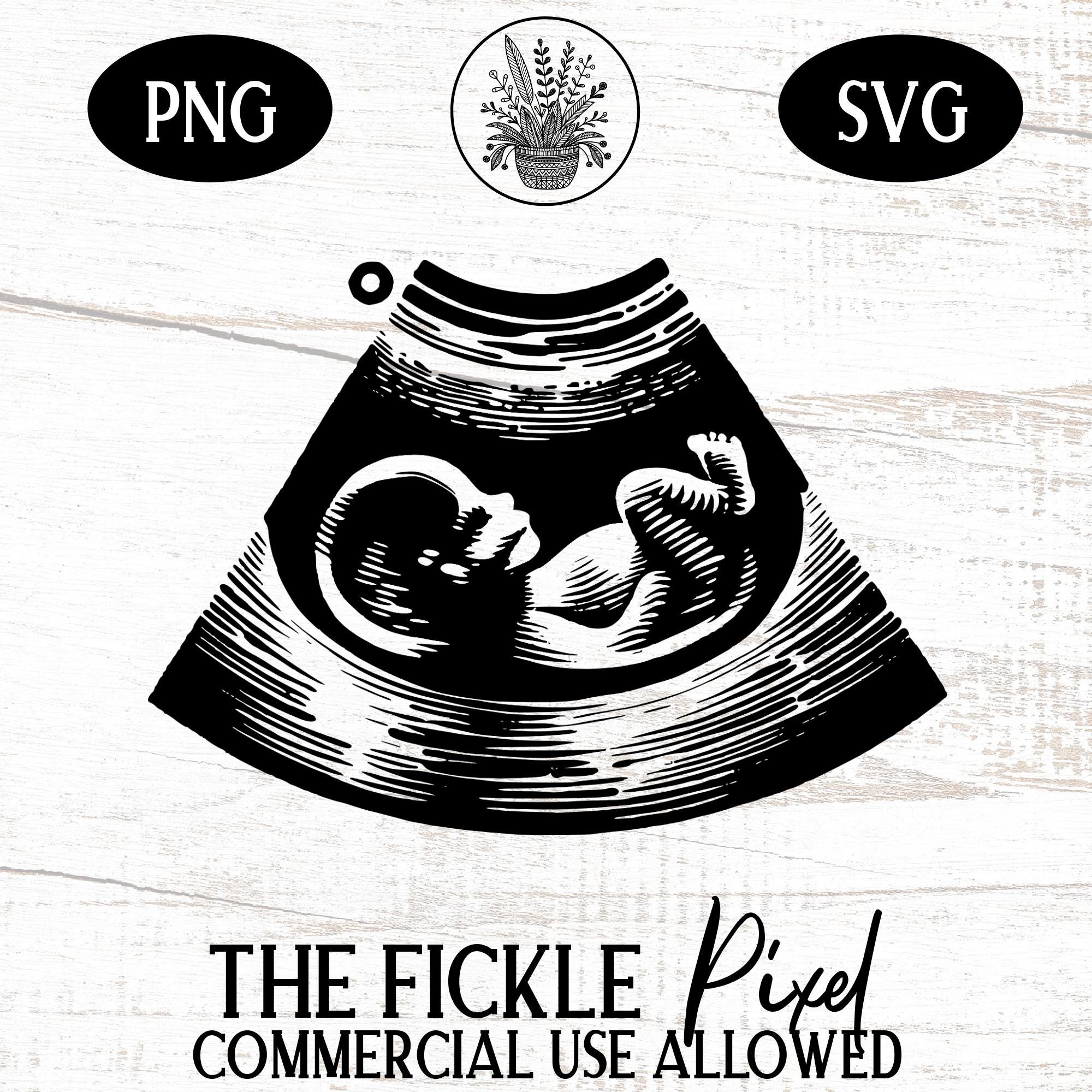 Ultrasound Sonogram Vector Clipart Png, Outline & Black Silhouette ...