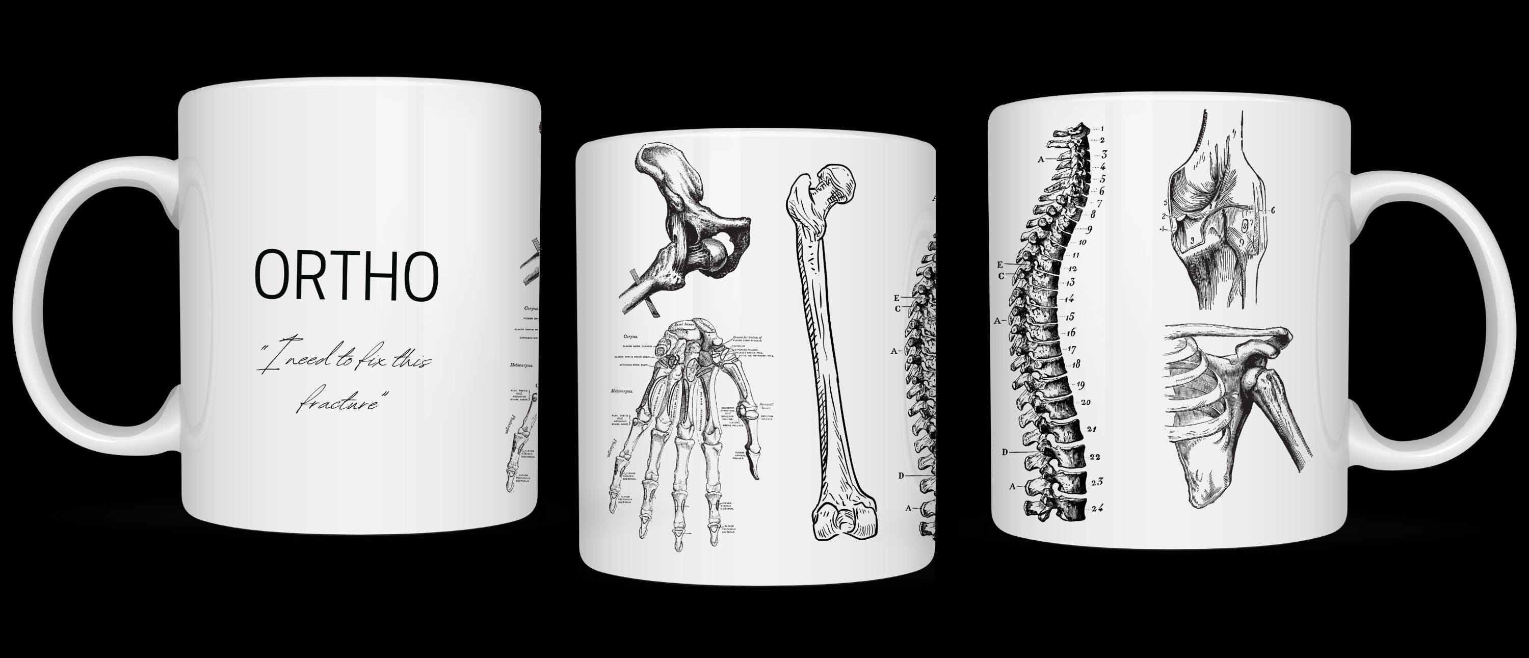 Orthopedic Surgery Mug, Bone Anatomy Coffee Cup, Orthopedist Gift Idea ...