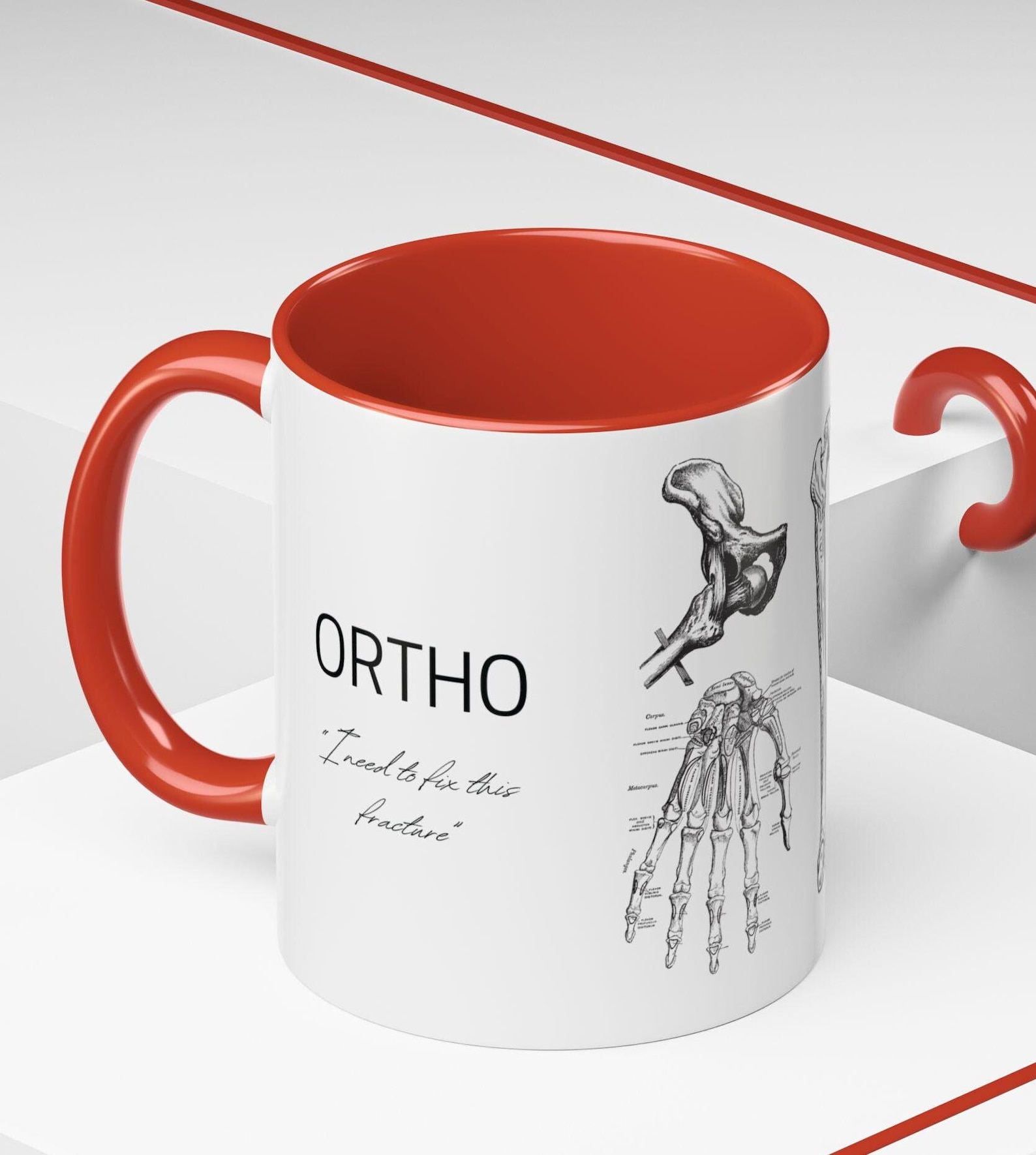 Orthopedic Surgery Mug, Bone Anatomy Coffee Cup, Orthopedist Gift Idea ...