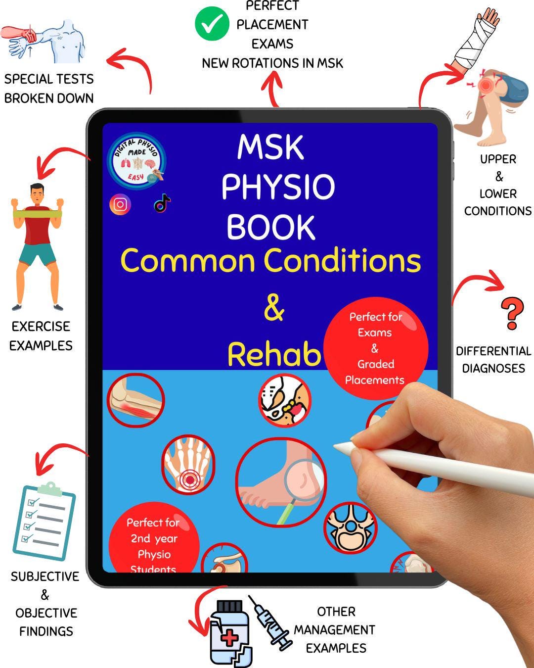 Digital-msk Physio 2nd Year Conditions & Rehab Revision Notes - Etsy