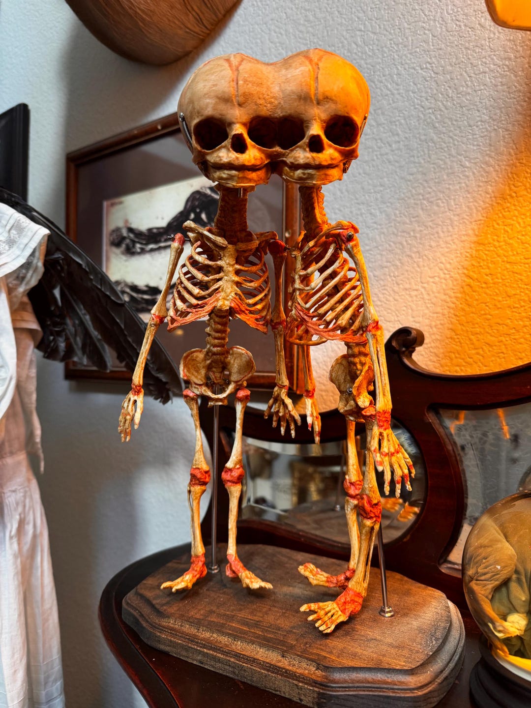 Conjoined Twins Two Headed Baby Skeleton - Etsy