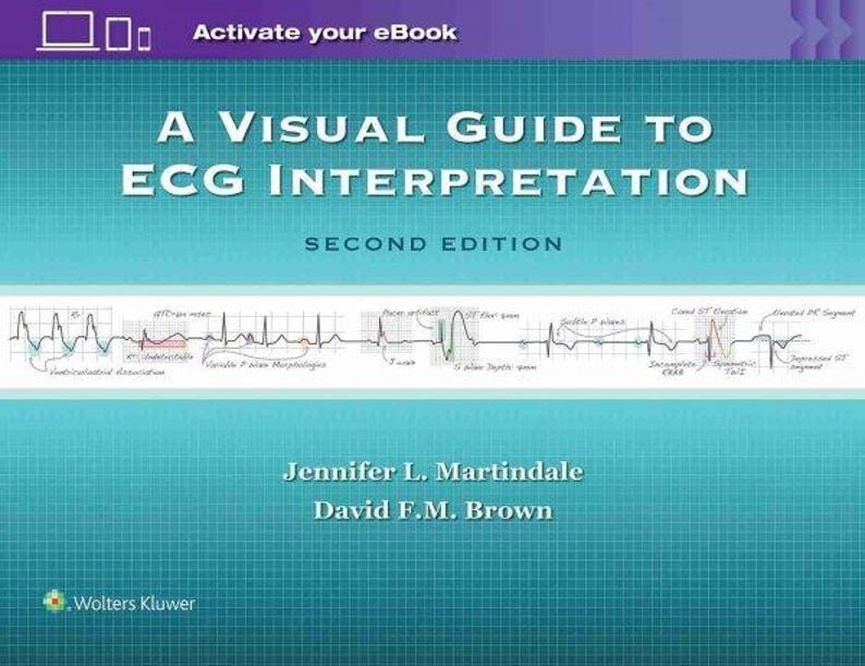 A Visual Guide to ECG Interpretation Second Edition - Etsy