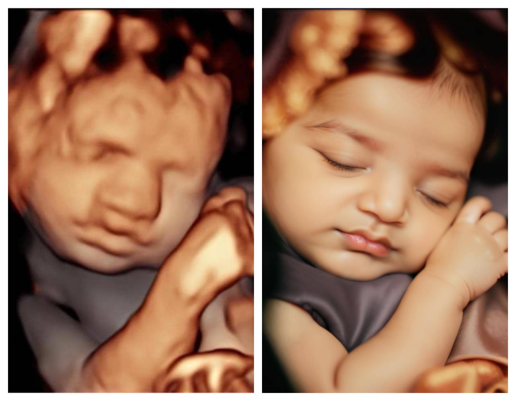 Ultrasound Transformation, Ultrasound Baby, First Baby Photo, 3d 4d 5d ...