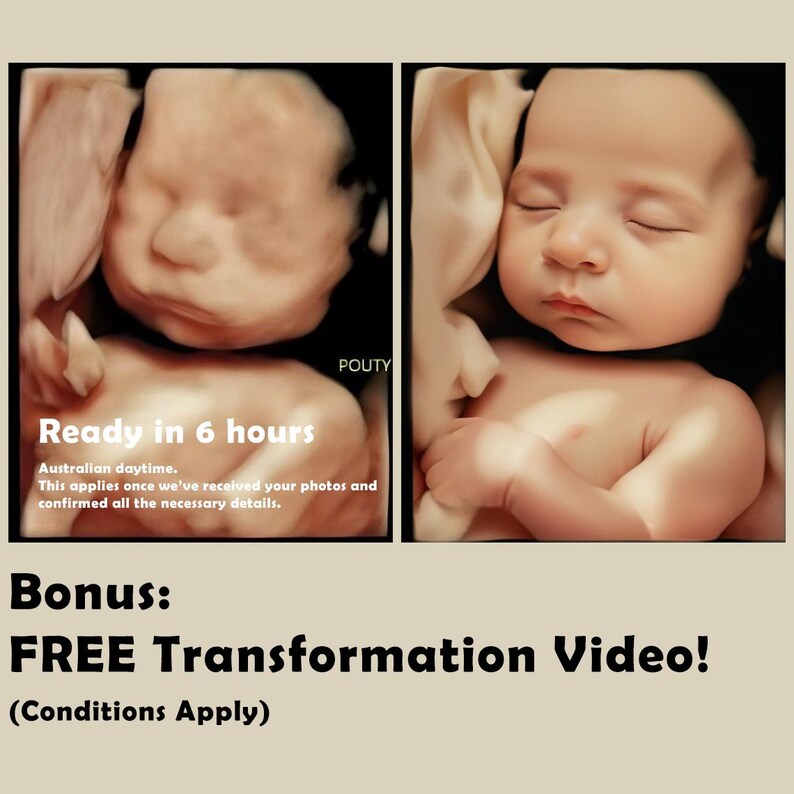 Ultrasound Transformation, Ultrasound Baby, First Baby Photo, 3d 4d 5d ...