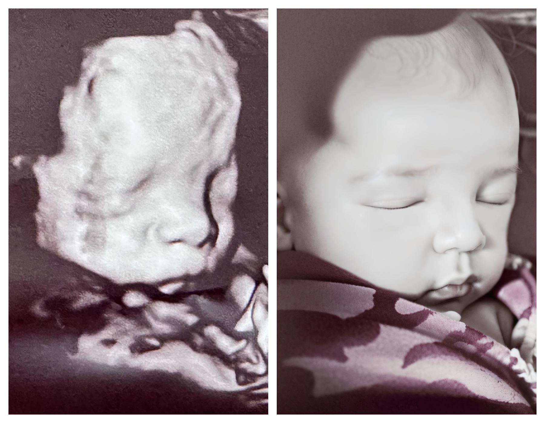 Ultrasound Transformation, Ultrasound Baby, First Baby Photo, 3d 4d 5d ...