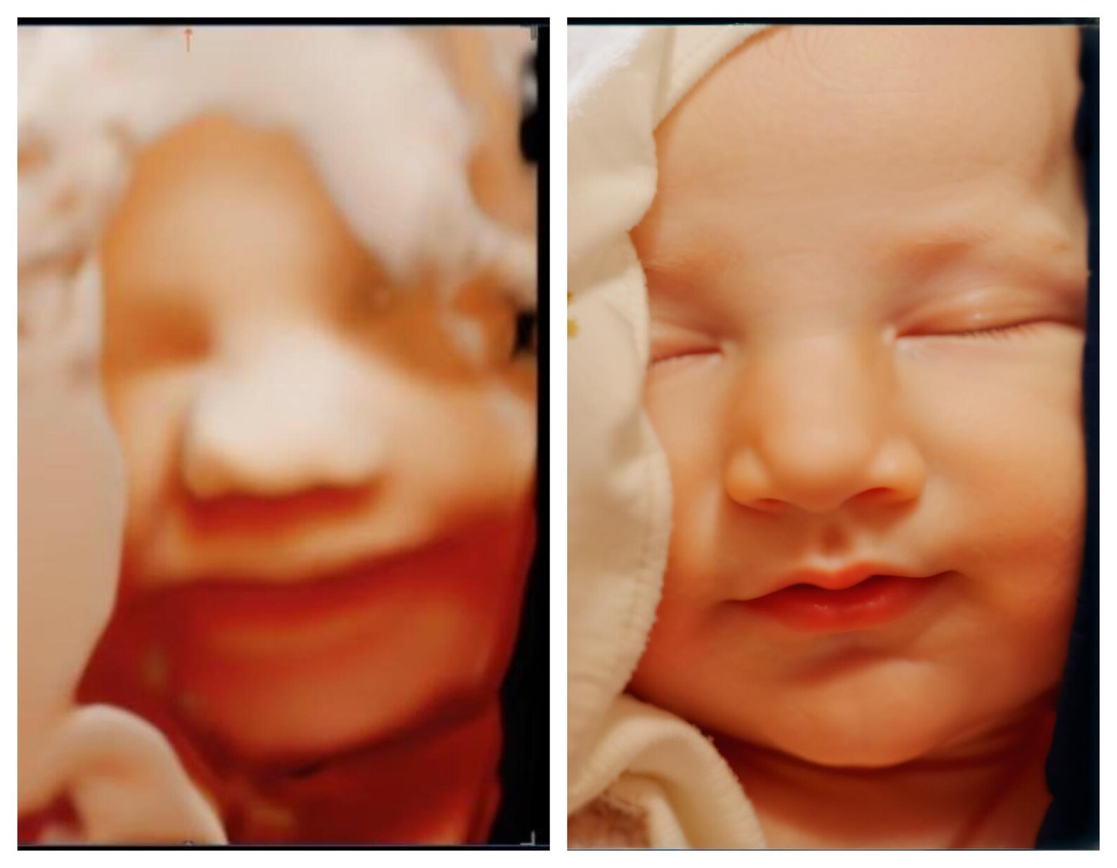 Ultrasound Transformation, Ultrasound Baby, First Baby Photo, 3d 4d 5d ...