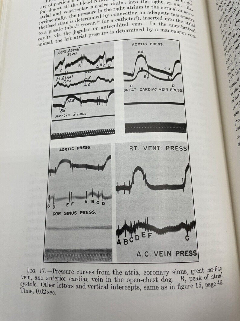 Coronary Circulation Signed 1950 Donald E. Gregg Hardcover Rare 227 ...
