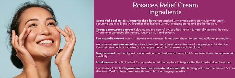 Rosacea Relief Cream - Etsy