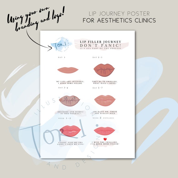 Aesthetics Clinic Injector Posters Lip Filler Journey With | Etsy