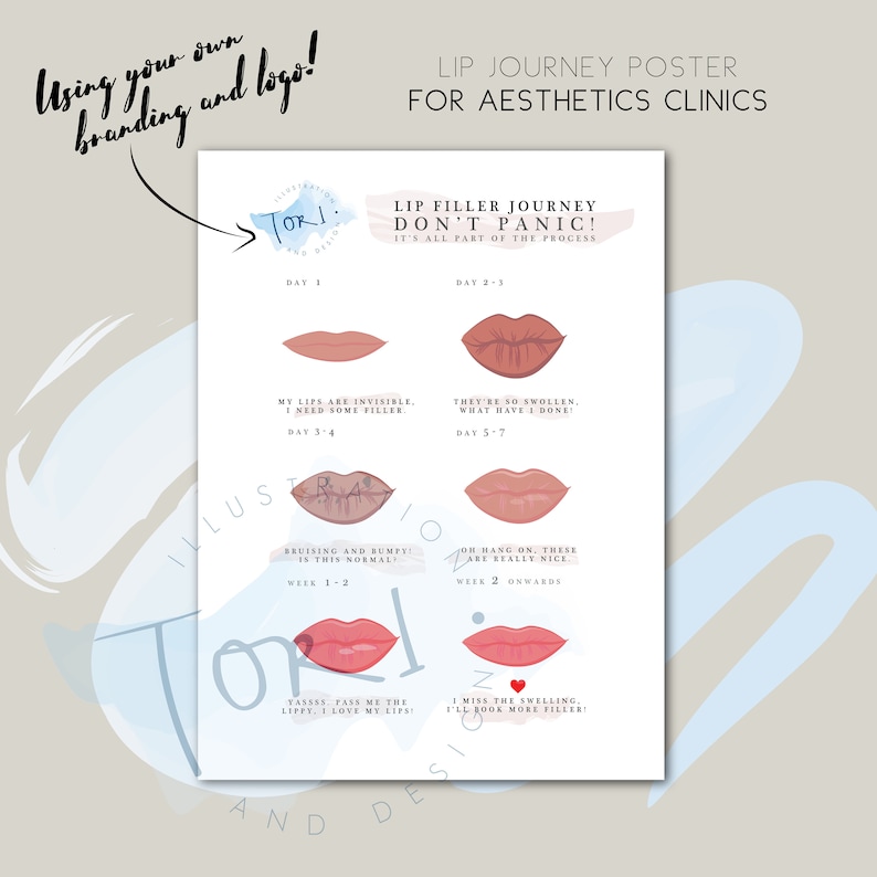 Aesthetics Clinic Injector Posters - Lip Filler Journey With Your ...