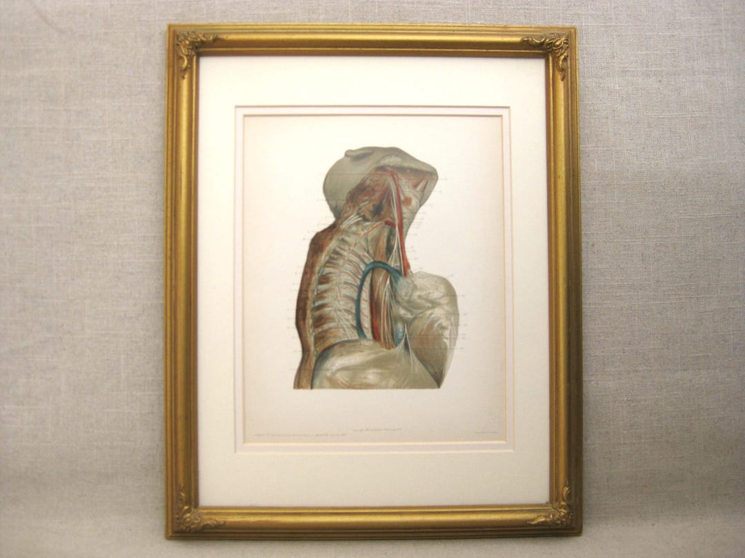 Antique Medical Illustration Book Plate, Original Framed Mcclellan ...
