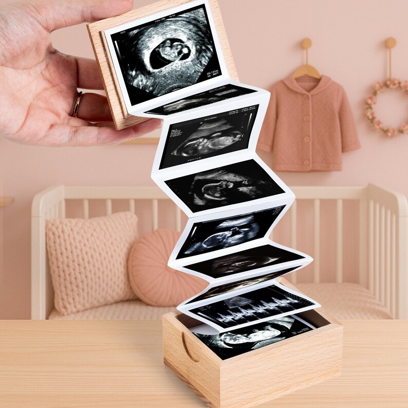 Custom Picture Box Ultrasound Photos Pull Out Memory Keepsake Box ...