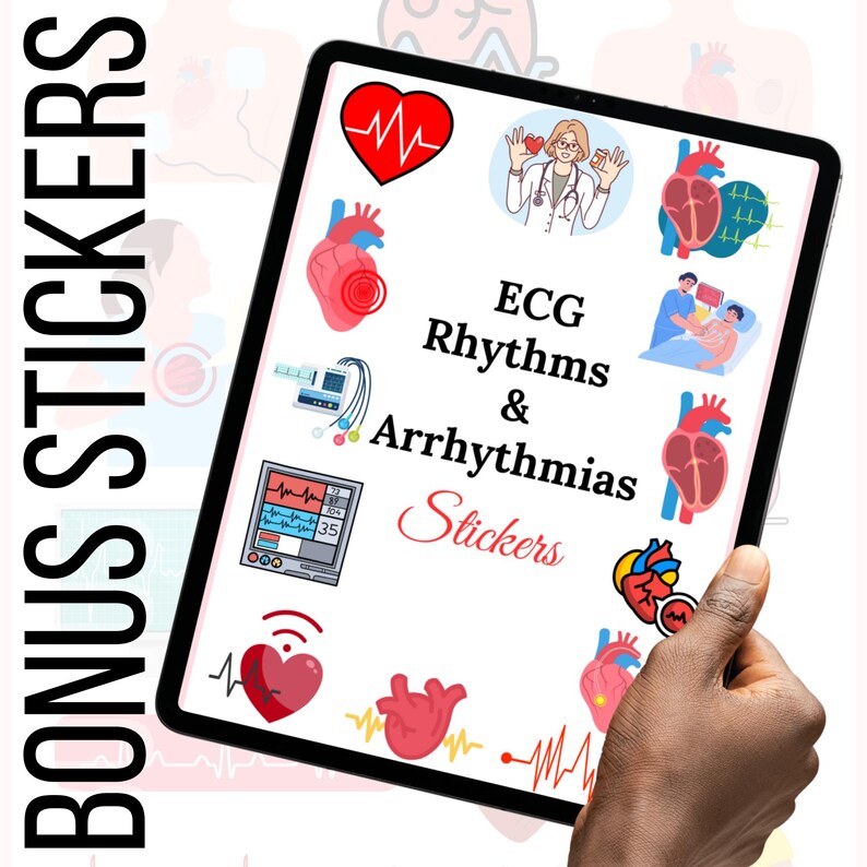 ECG Rhythm Arrhythmias Cheat Sheet ECG Study Guide Nursing Notes Cheat ...