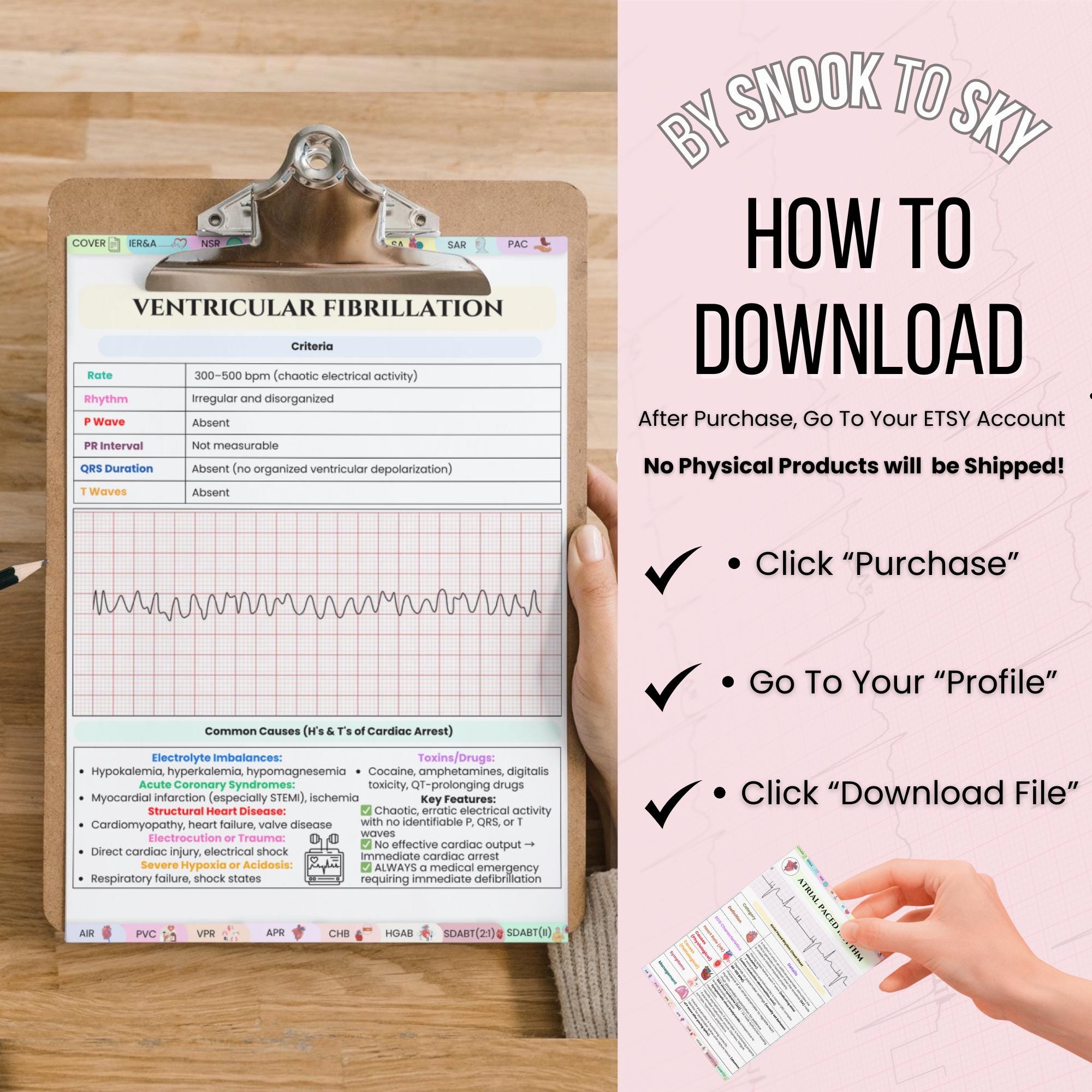 ECG Rhythm Arrhythmias Cheat Sheet ECG Study Guide Nursing Notes Cheat ...