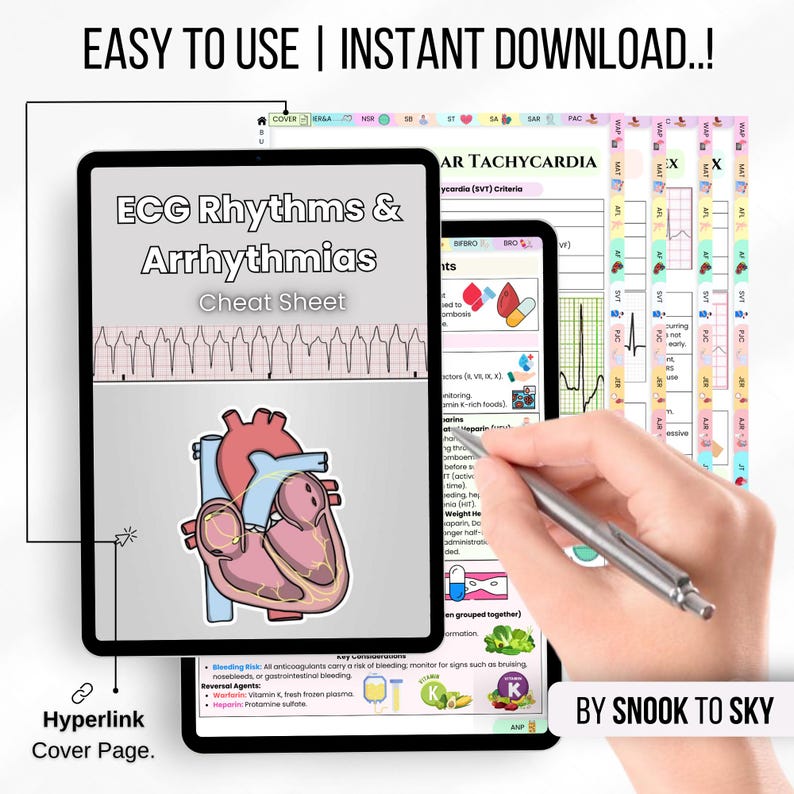 ECG Rhythm Arrhythmias Cheat Sheet ECG Study Guide Nursing Notes Cheat ...