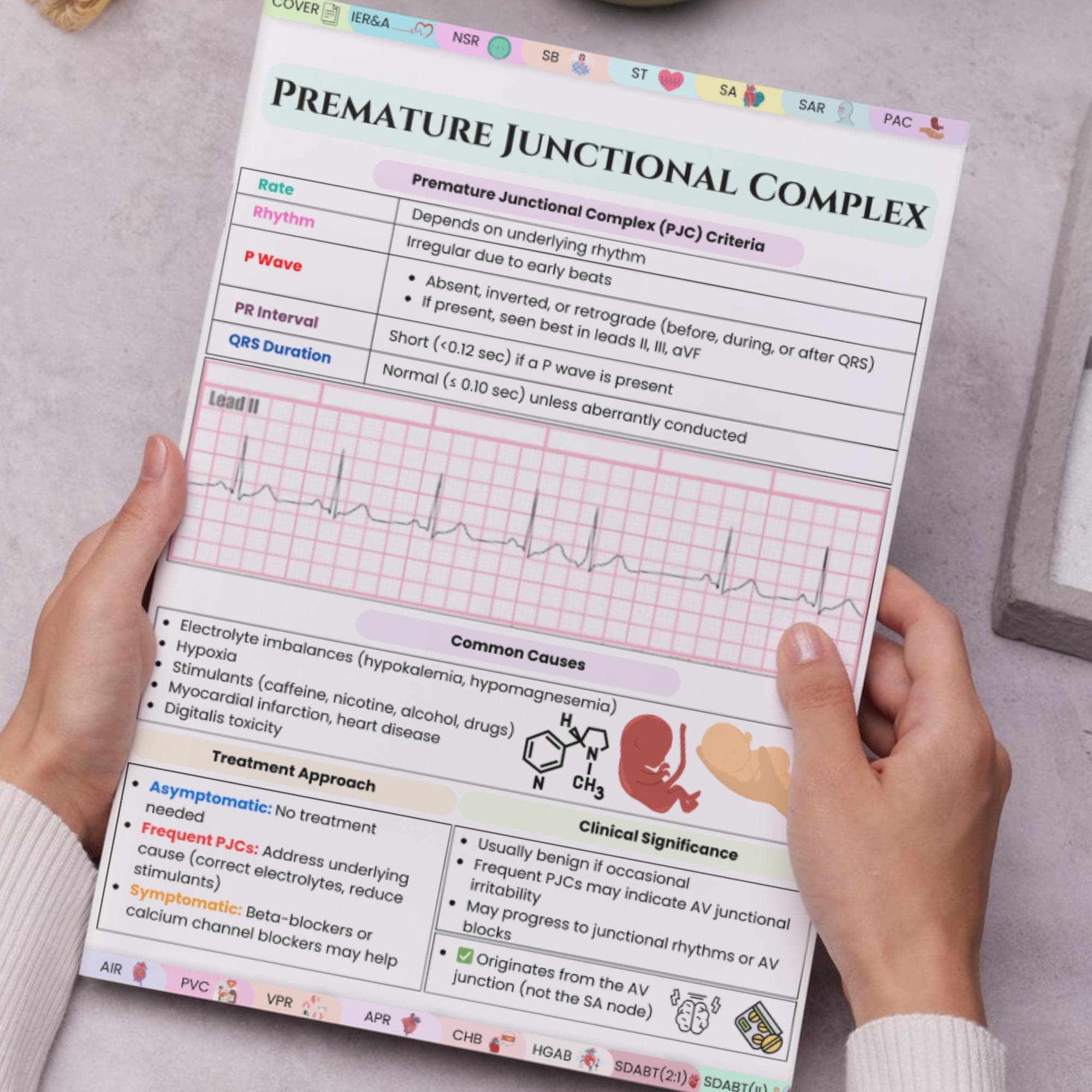 ECG Rhythm Arrhythmias Cheat Sheet ECG Study Guide Nursing Notes Cheat ...