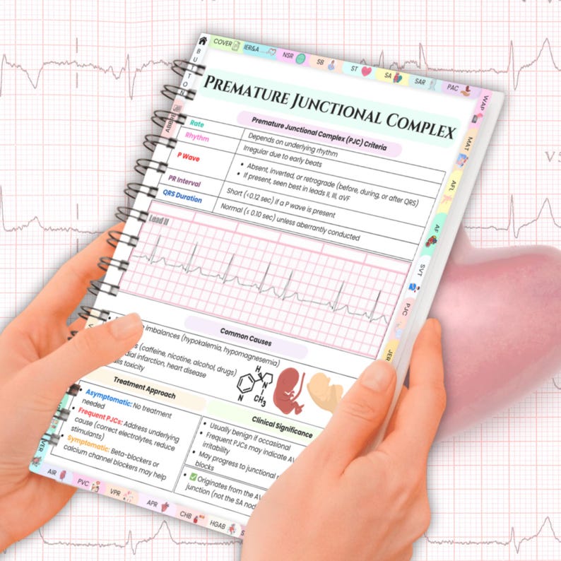 ECG Rhythm Arrhythmias Cheat Sheet ECG Study Guide Nursing Notes Cheat ...