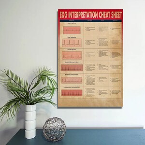 Ekg Interpretation Poster - Etsy