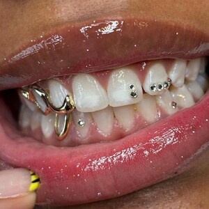 Wavy Freeform Cap in Dental Gold & Sterling Silver (3 Teeth) Custom ...