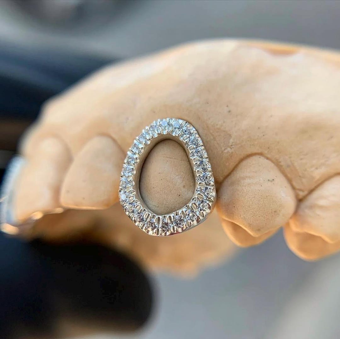 Iced Out Diamond Open Face Window Cap Dental Gold & Sterling Silver ...