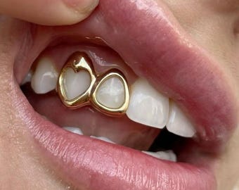 Window Inlay Tip Cap in Dental Gold & Sterling Silver Custom Made ...