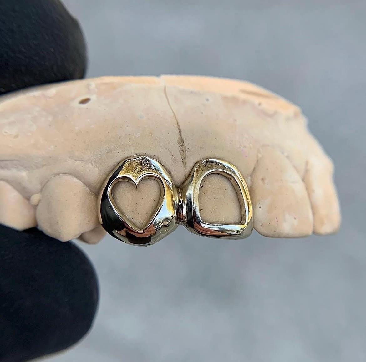 Heart + Open Face Window Cap in Dental Gold & Sterling Silver Custom ...