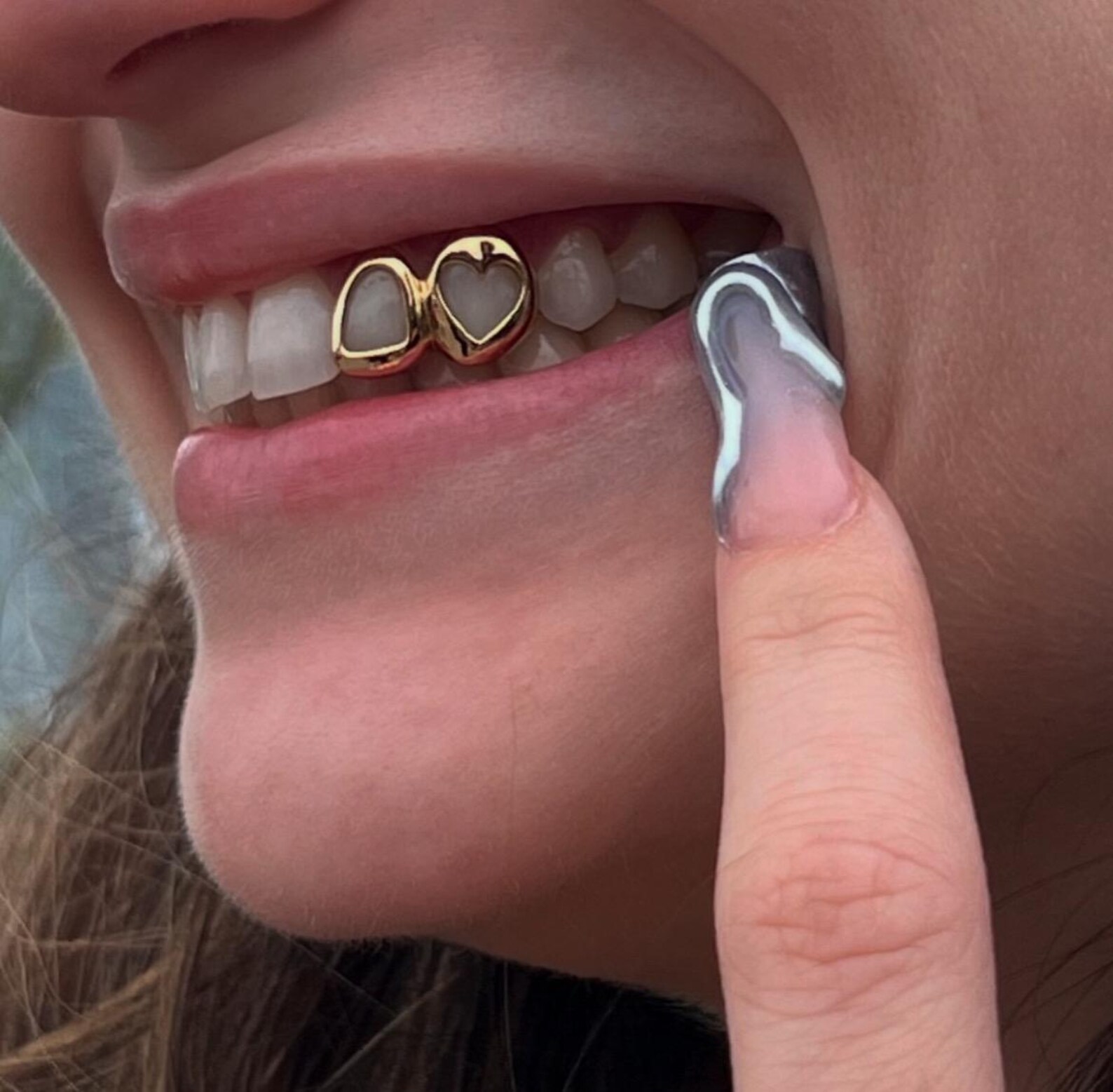 Heart + Open Face Window Cap in Dental Gold & Sterling Silver Custom ...