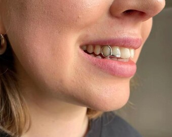 Window Inlay Tip Cap in Dental Gold & Sterling Silver Custom Made ...