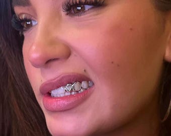 Window Inlay Tip Cap in Dental Gold & Sterling Silver Custom Made ...