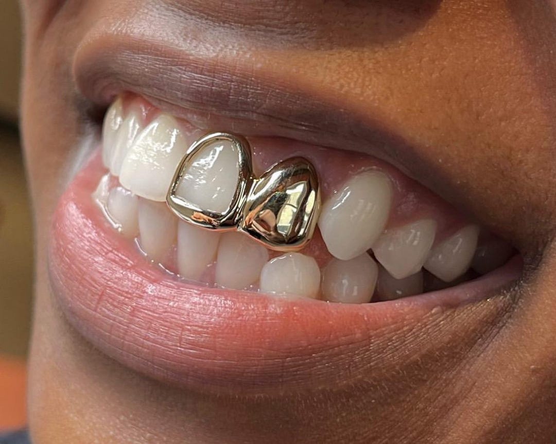 Window + Plain Cap in Dental Gold & Sterling Silver Custom Made Grillz ...