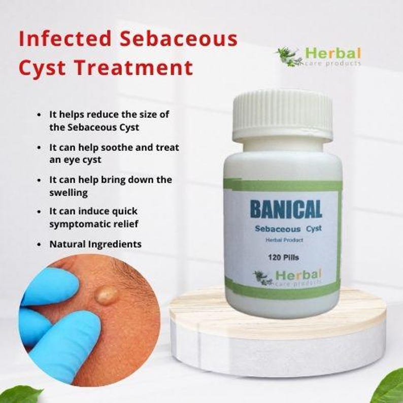 2 Pack Infected Sebaceous Cyst Treatment Supplements for Sebaceous Cyst ...