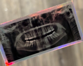 Dental X-ray Bitewing Sticker - Etsy