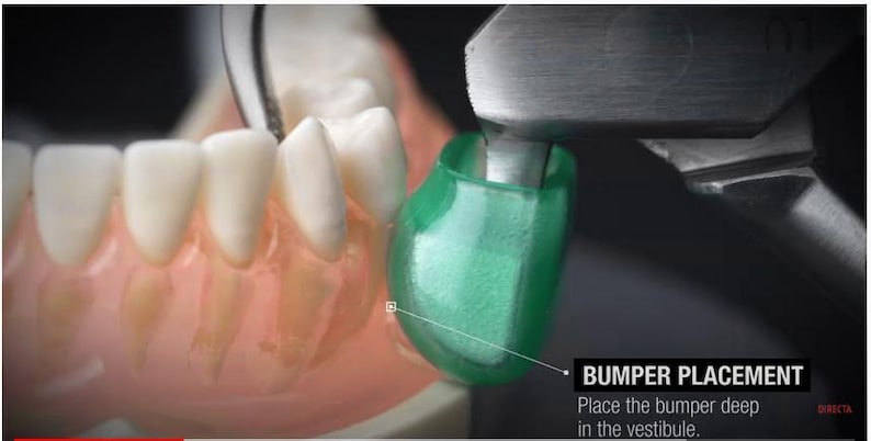 Dental Extraction Forceps Molar Series Set of 4 Pcs Dental Forceps ...